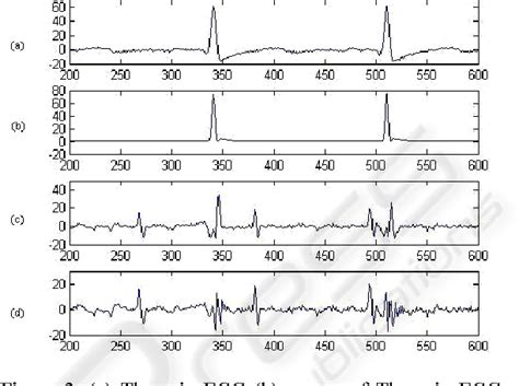 Extraction Of Fetal ECG From Abdominal Signal Semantic Scholar