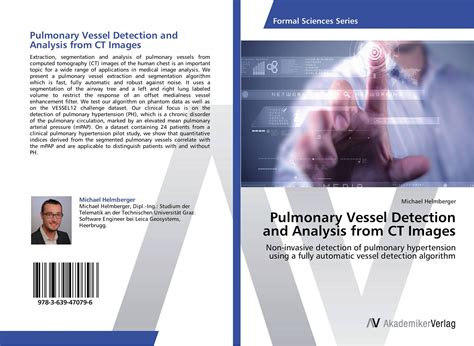 Купить Pulmonary Vessel Detection And Analysis From Ct Images Non Invasive Detection Of
