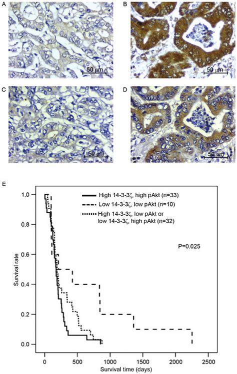 Expression Of 14 3 3ζ And Pakt Ser 473 In Human Cca Tissues