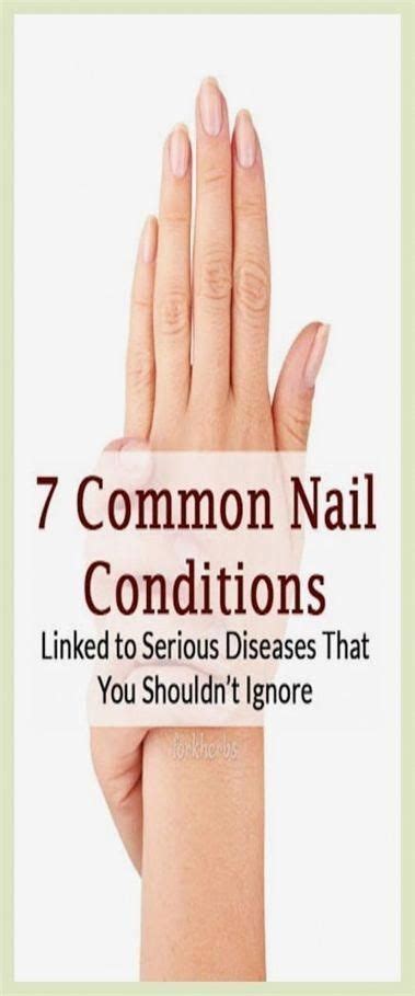 7 Common Nail Conditions Linked To Serious Diseases That You Shouldnt