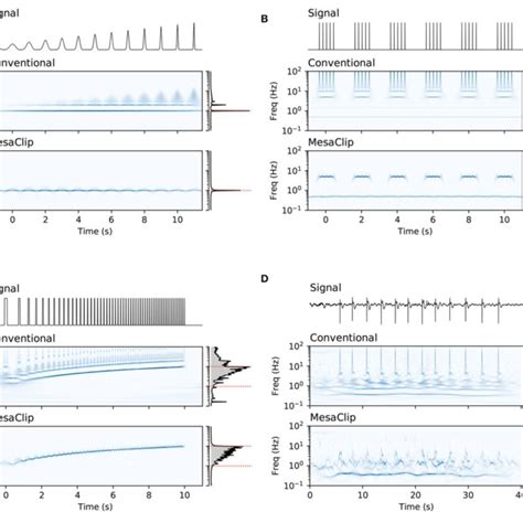 The Performance Of Different Noise Reduction Methods Normal Ecg Waveform Download