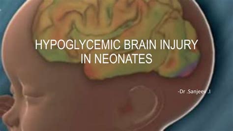 Neonatal Hypoglycemia Approach Diagnosis And Management Pptx