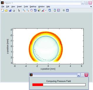 K Wave MATLAB Toolbox For The Simulation And Reconstruction Of Photoacoustic Wave Fields