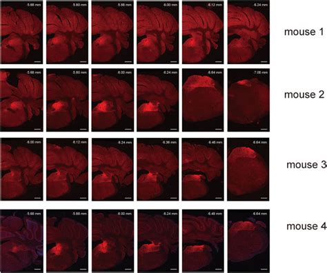 Whole Brain Monosynaptic Outputs And Presynaptic Inputs Of Gabaergic