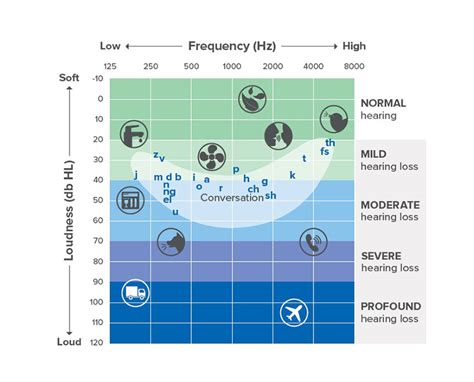 Audiogram Results Explained Audika