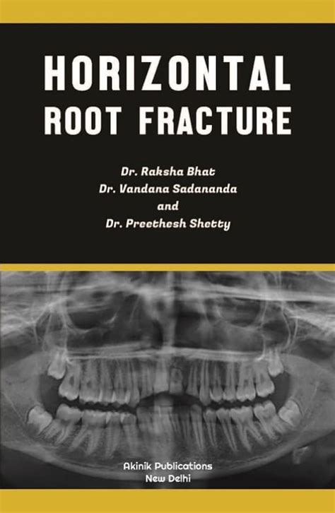 Horizontal Root Fracture
