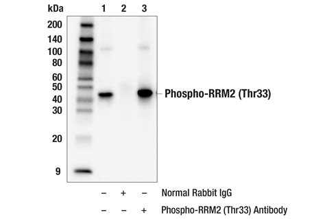 Phospho Rrm2 Thr33 Antibody Cell Signaling Technology