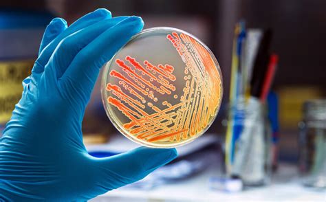 Causes And Effects Of Water Pollution Atlas Scientific