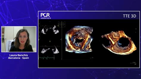 Echocardiographic Imaging For Transcatheter Tricuspid Intervention