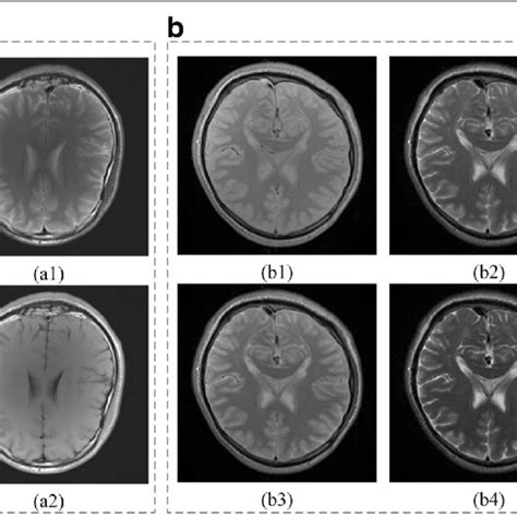 PDF Joint Sparse Reconstruction Of Multi Contrast MRI Images With Graph Based Redundant