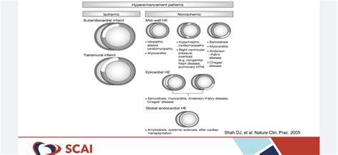 Thread By Oncocardiology I Will Share My Talk This Was The