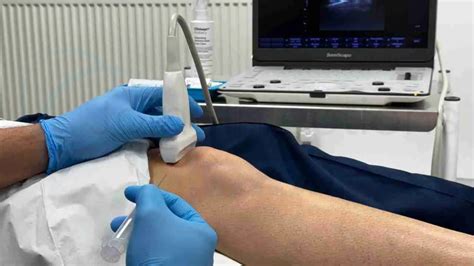 Injections For Pes Anserinus Bursitis Steroid Injections