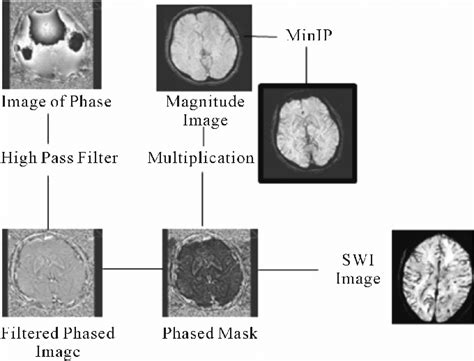 Scheme Of The SWI Process From Toshi M Et Al Download Scientific Diagram