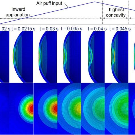 Corneal Responses To An Air Puff Captured By High Speed Camera A