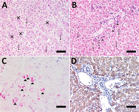 Photomicrographs Of Liver From Human Patient A C And Callicebus Spp