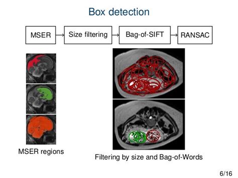 Automated Fetal Brain Segmentation From 2d Mri Slices For Motion Corr