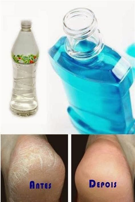 Dicas Sugestivas Úteis E NecessÁrias Dica Para Ter PÉs Macios