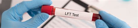 Understanding The Basics Of Liver Function Tests HOD