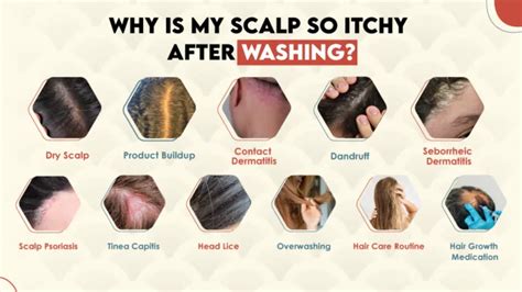 Why Does My Scalp Itch A Day After Washing Happy Cappy