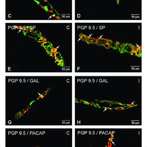 Enteric Cells In Porcine Duodenal Myenteric Plexuses In Physiological