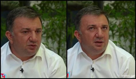 რა სერიოზული დაავადება აღმოაჩნდა პაატა გულიაშვილს მსახიობის აღიარება