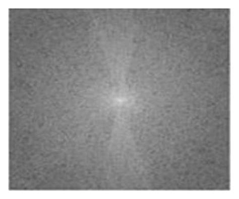 Medical Image And Its Frequency Domain Spectrum Display A Medical