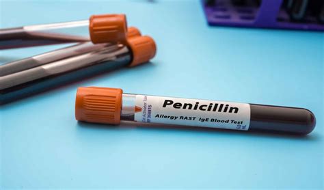 How Penicillin Allergy Testing Improves Patient Care