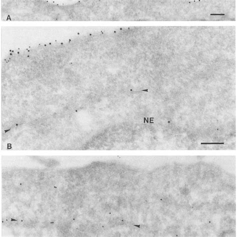 Immunogold Detection Of Hc A2 10 Nm Gold And Hc 10 15 Nm Gold Bar