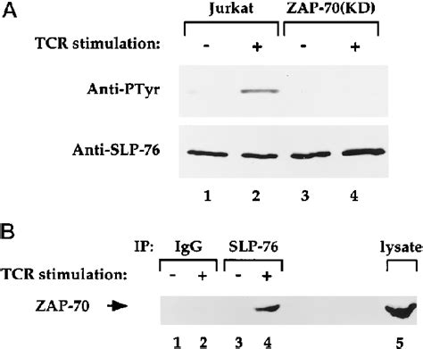 A Tyrosine Phosphorylation Of Slp 76 Requires The Catalytic Activity