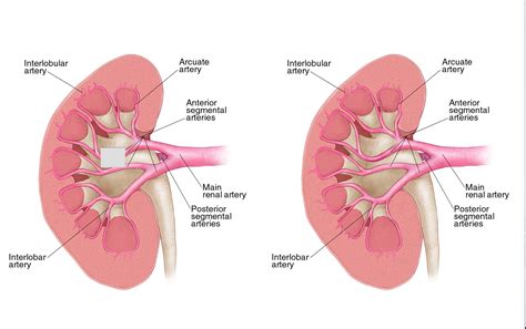 Renal Ctisus Cutting Edge Information On Body Ct Computed