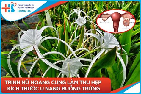 Thuốc trị u nang buồng trứng hiệu quả đến Tìm hiểu ngay