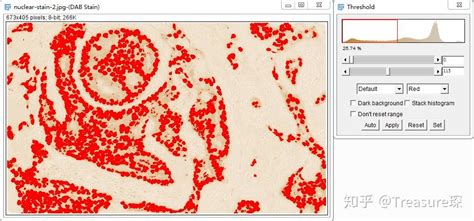 Imagej实用技巧——免疫组化分析 定量分析篇 知乎