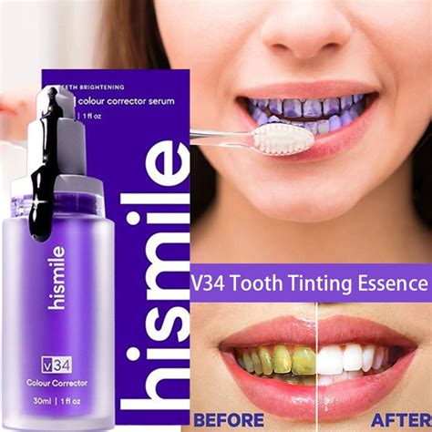 High Smlie Teeth Whitening Sahoolat Store