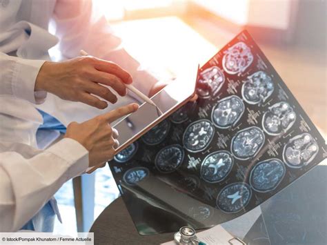Tumeur au cerveau causes symptômes évolution et stades traitements