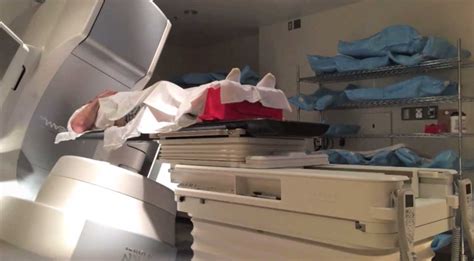 Radiotherapy For Prostate Cancer All About Radiation