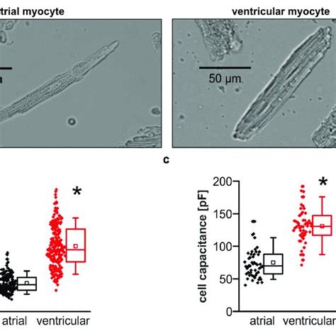Basic Differences In Morphometry Between Atrial And Ventricular