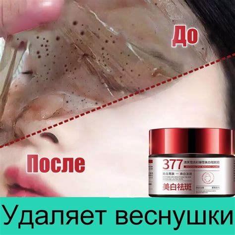 Крем для лица от Веснушек и Пигментных пятен 30г против пигментации отбеливающий для лица