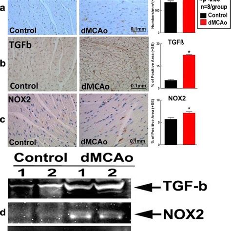 Stroke Significantly Induces Cardiac Inflammation And Oxidative Stress