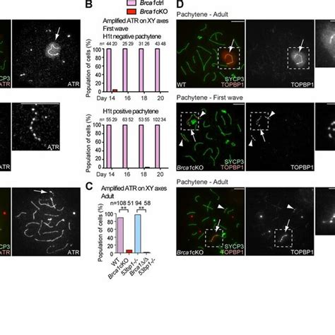 Brca1 Amplifies Atr And Topbp1 On Unsynapsed Sex Chromosomes A