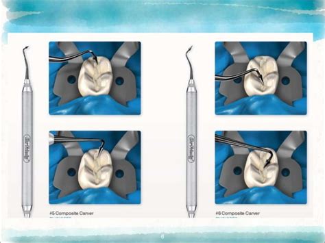 techniques of direct composite restoration ppt