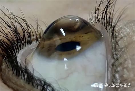 专业角度教你验光配镜早上8 11点最佳验光时间还有这些细节 知乎