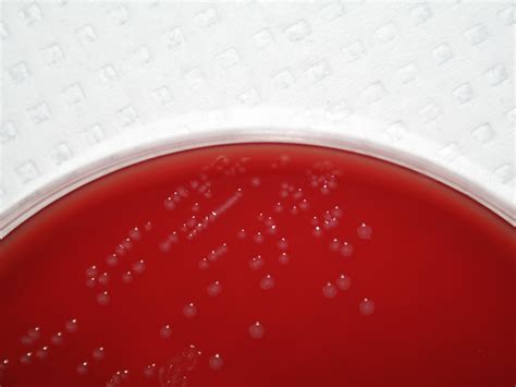 Pasteurella Multocida Lab Identification