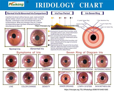 Left Iris Analysis Decoding Constitutional Types And Genetic Markers