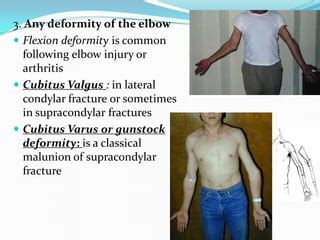 Elbow Examination Pdf