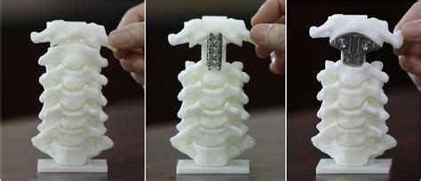 Which Parts Of The Body Can We 3d Print World Economic Forum