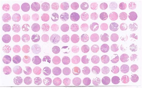 Hematoxylin And Eosin Hande Staining Of The Tissue Microarray Tma Download Scientific Diagram