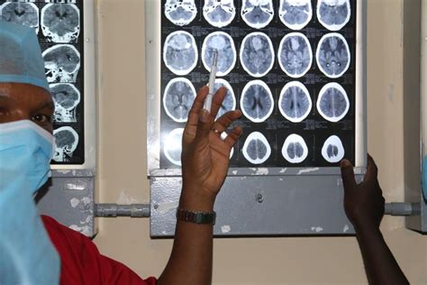 Dr Kiboi Explains Olfactory Groove Meningioma To Mmed Students