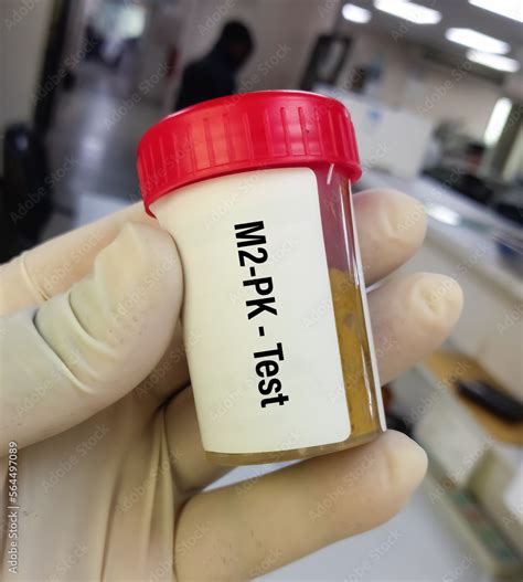 Stool Sample For M2 Pyruvate Kinase M2 Pk Test Is A Non Invasive Stool Test Used To Early