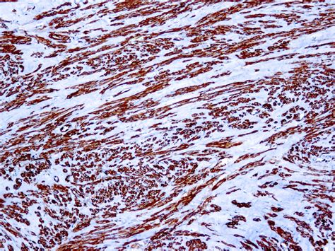 Actin Muscle HHF35 MOB002 Histoline