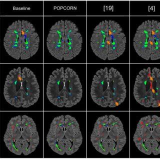 Comparison Of POPCORN Uncertainty Guided Pseudo Labeling 19